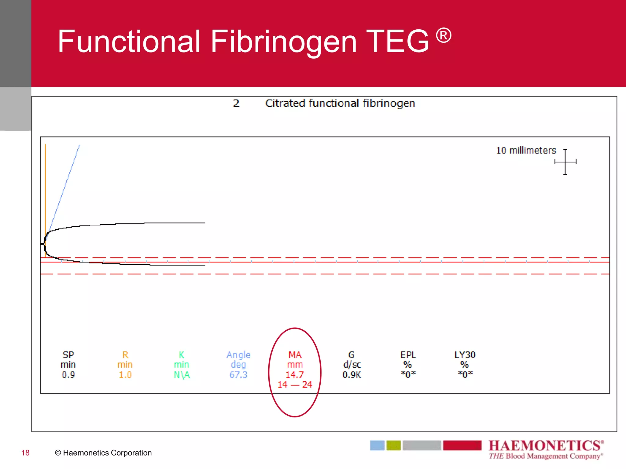 TEG 6s presentation | PPTX