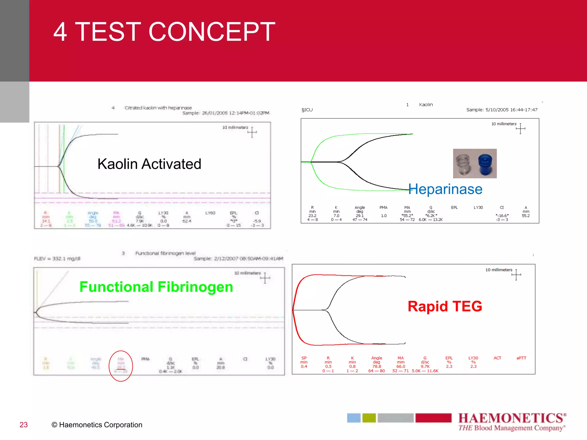 TEG 6s presentation | PPTX