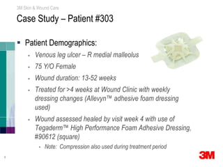 3M Tegaderm High Performance Foam: Case Study | PPTX
