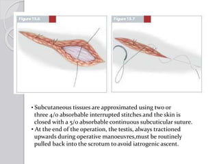 TEHNIK_OPERASI_HERNIOTOMY_RIY.pptx