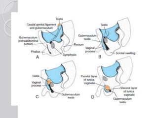 TEHNIK_OPERASI_HERNIOTOMY_RIY.pptx