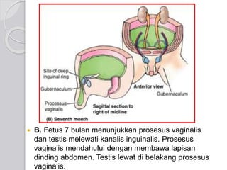 TEHNIK_OPERASI_HERNIOTOMY_RIY.pptx