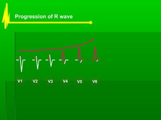 Tehnik pemeriksaan ekg | PPT
