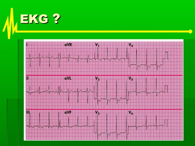 Tehnik pemeriksaan ekg | PPT
