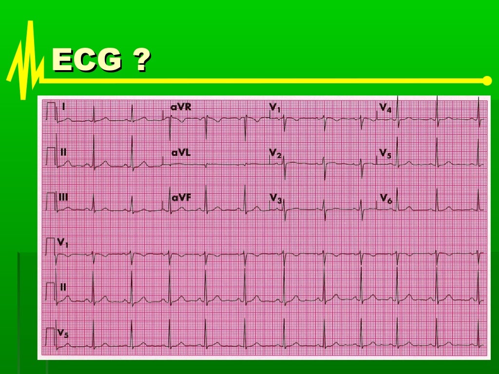 Tehnik pemeriksaan ekg