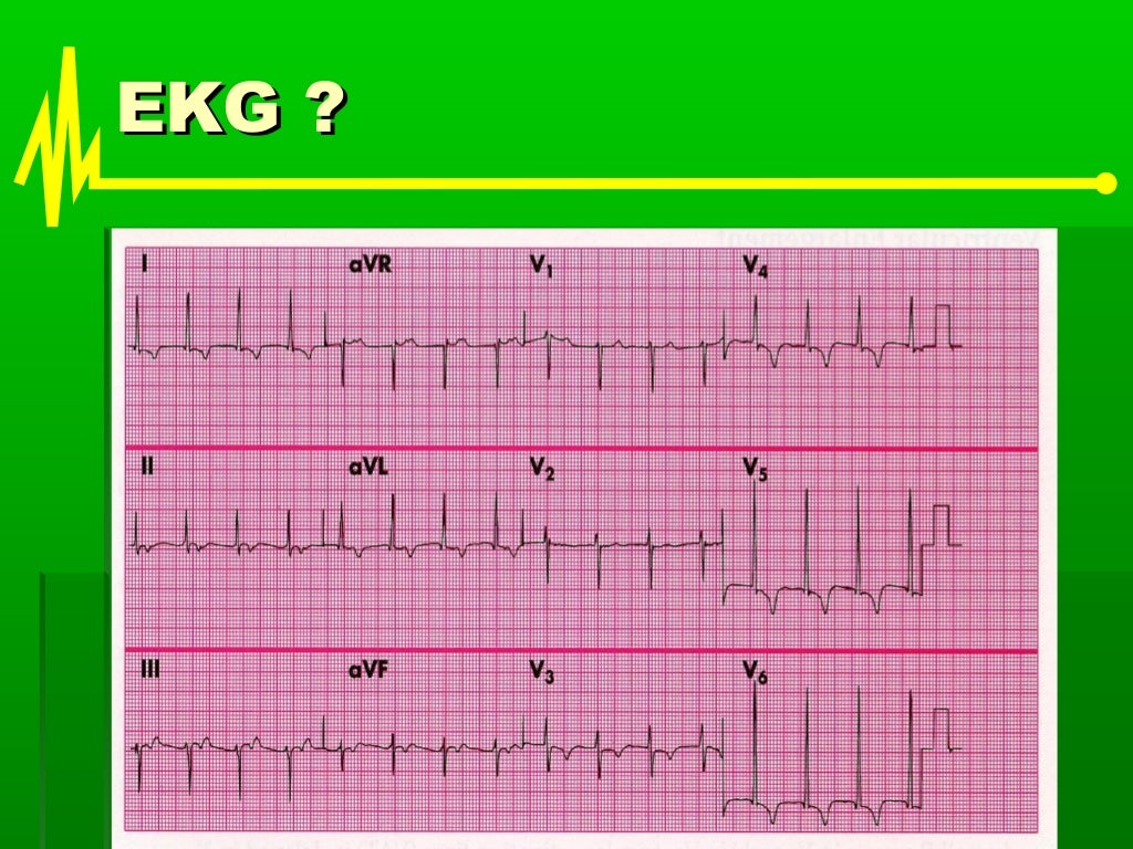 Tehnik pemeriksaan ekg