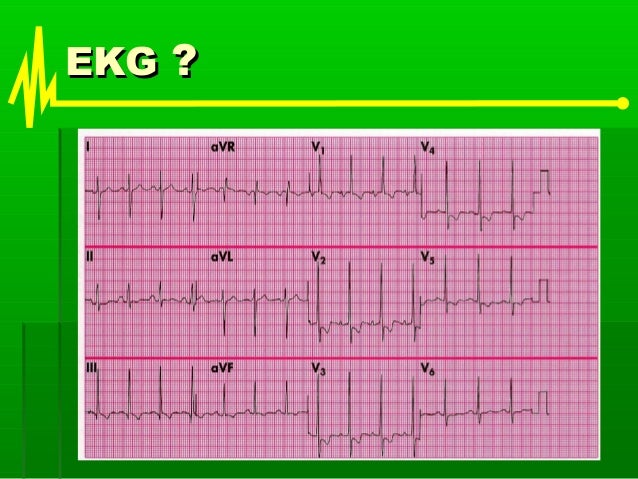 Tehnik pemeriksaan ekg