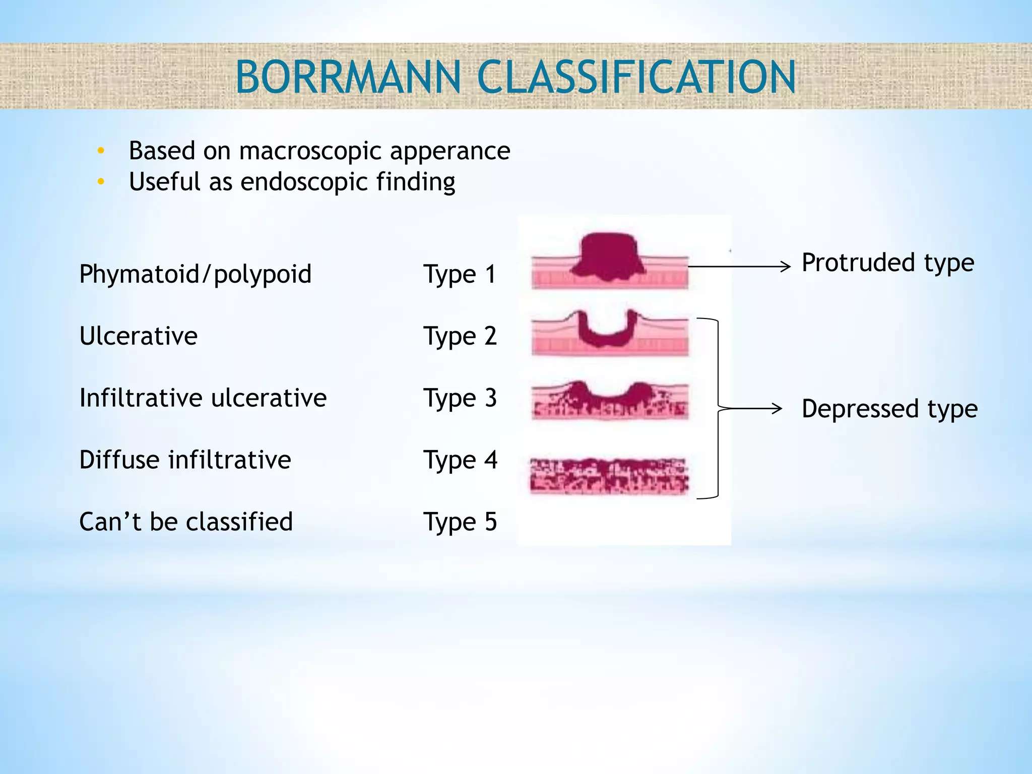 Gastric Cancer / Carcinoma management | PPTX
