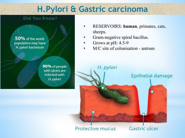 Gastric Cancer / Carcinoma management