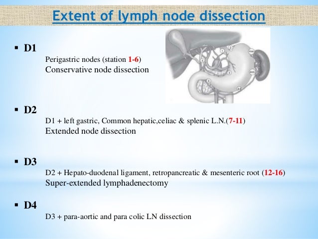 Gastric Cancer Carcinoma Management