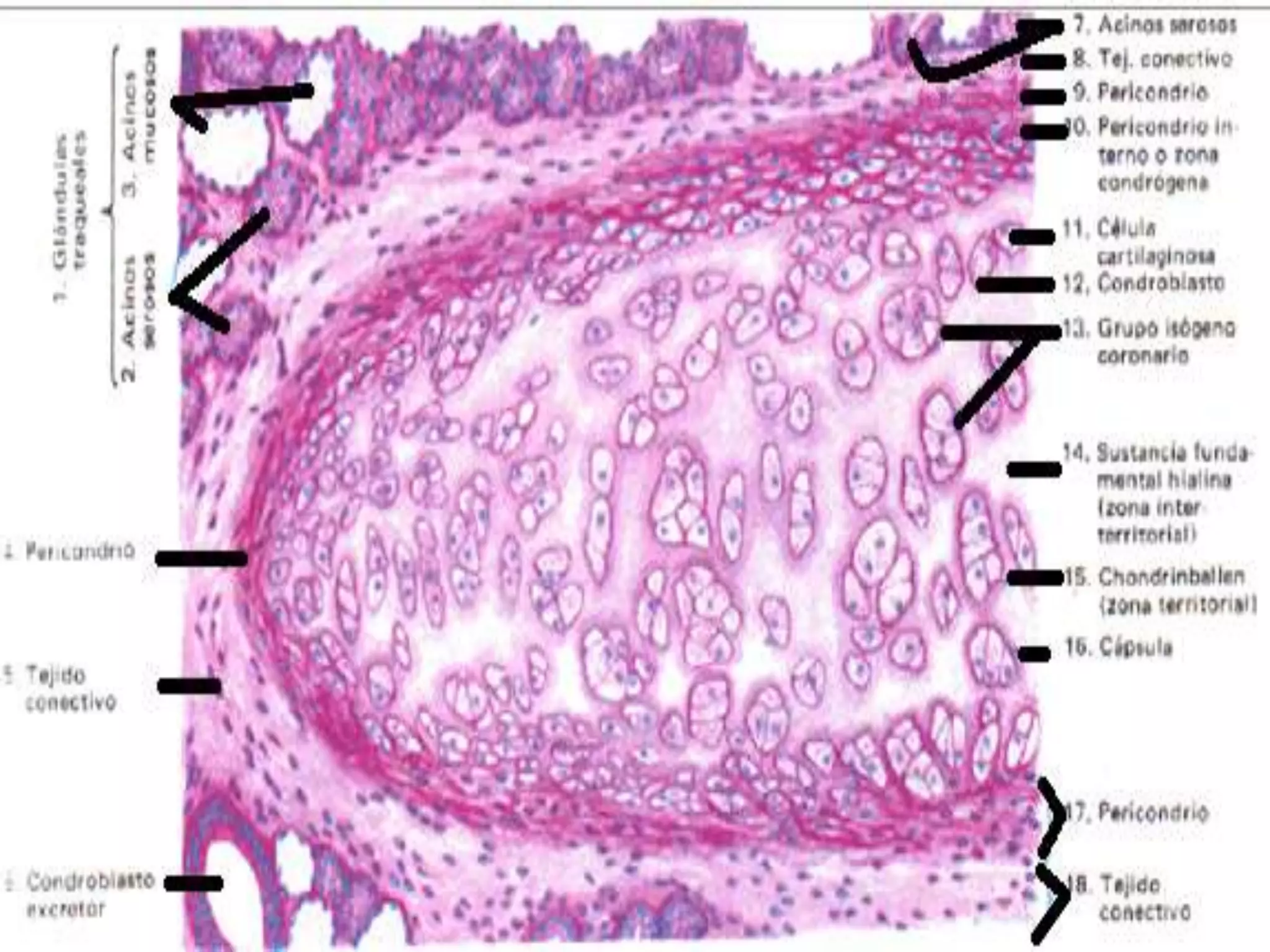 FIBROCARTILAGO | PPTX