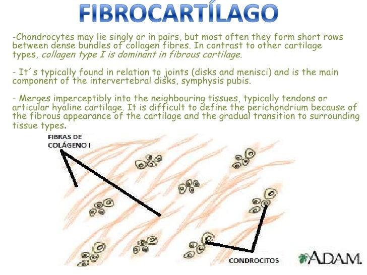 Diagramadefibrocartilago