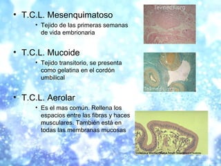 Tejido conectivo | PPT