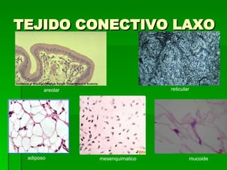 Tejido Conectivo1 | PPT | Biological Sciences | Science