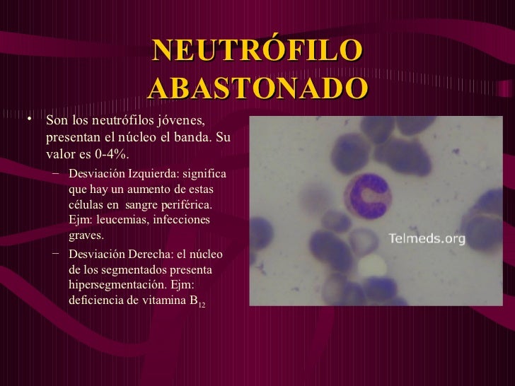 Neutrófilos Altos No Hemograma: O Que Significa? – HHCT