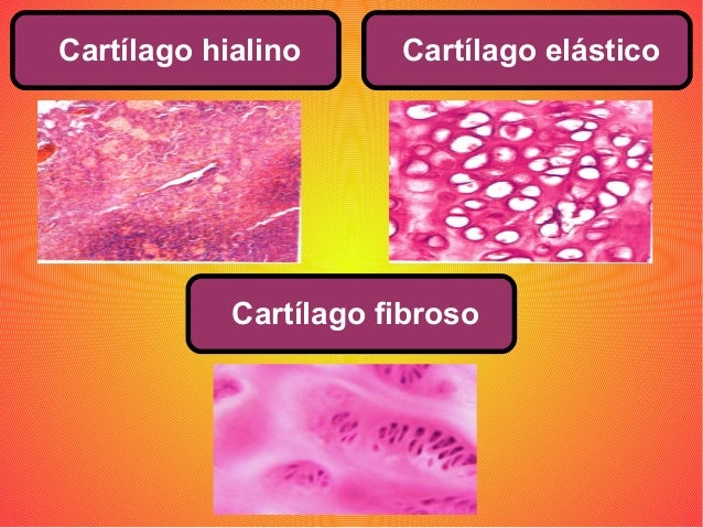 Tejido cartilaginoso