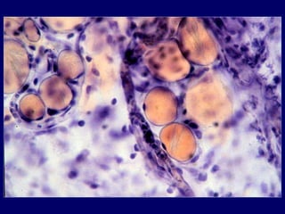 Histología - Tejido conectivo - Dr. Requena | PPT
