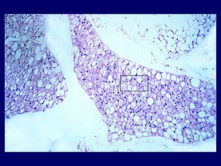 Histología - Tejido conectivo - Dr. Requena | PPT