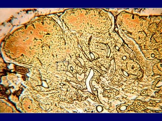 Histología - Tejido conectivo - Dr. Requena | PPT