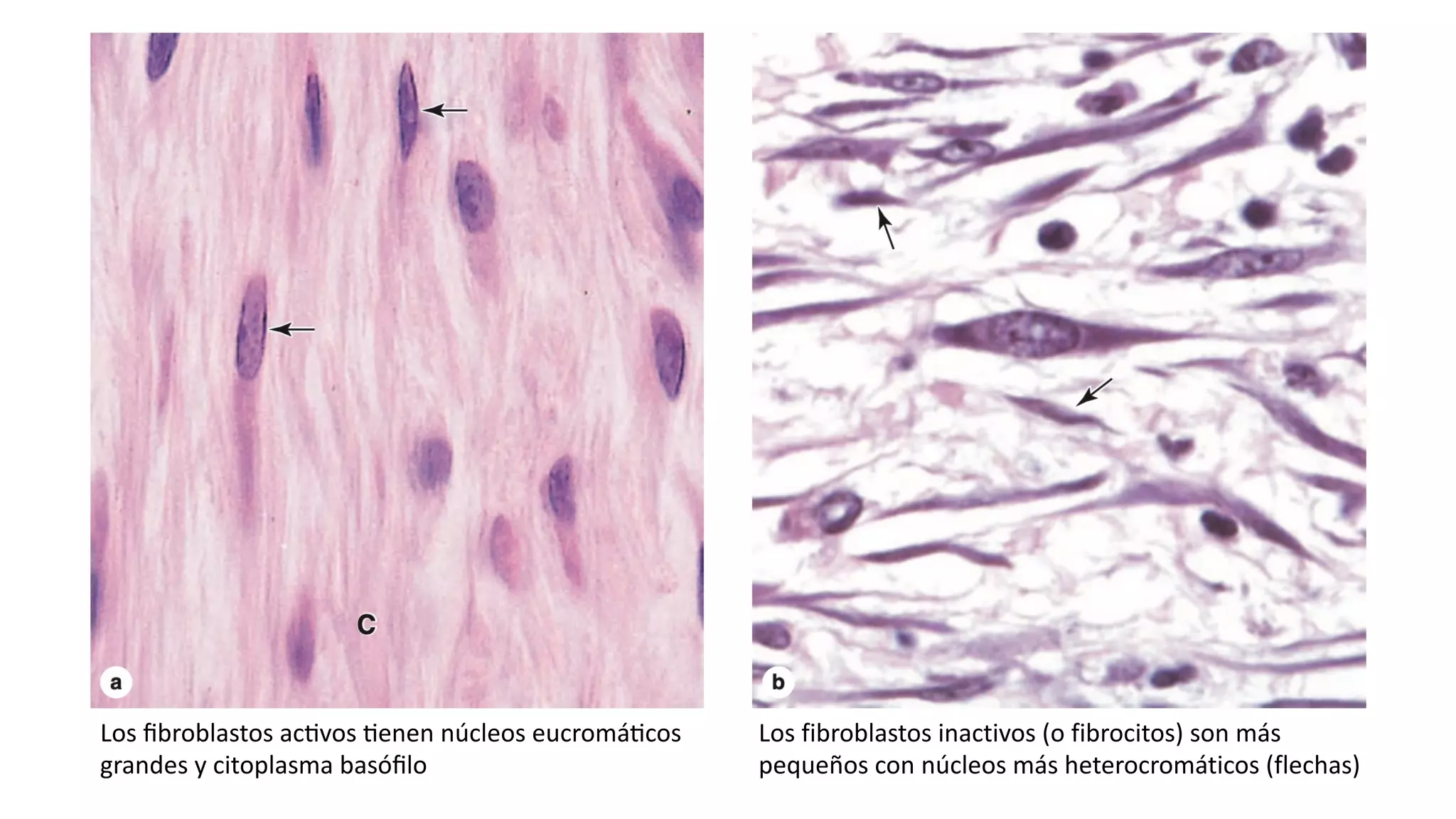 Tejido Conectivo - Histología | PDF