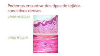 Tejido conectivo denso | PPTX