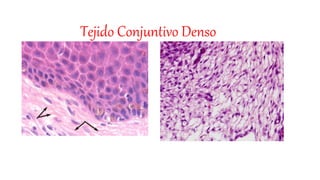 Histologia De Tecido Conjuntivo Denso Irregular