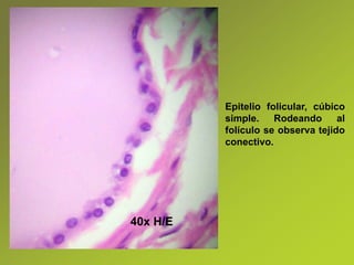 Epitelio Folicular
