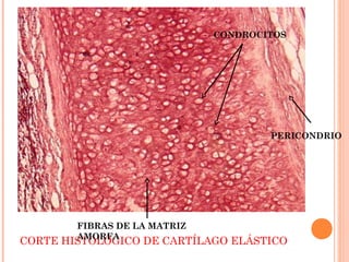Tejido esqueletico | PPT