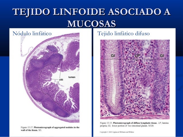 Histología de tejido linfoide
