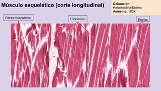 Tejido muscular | PPTX