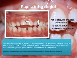 Tejidos del periodonto en el niño y anciano | PPTX