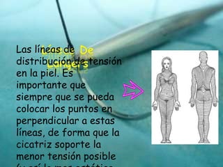 Tejido tegumentario suturas | PPTX