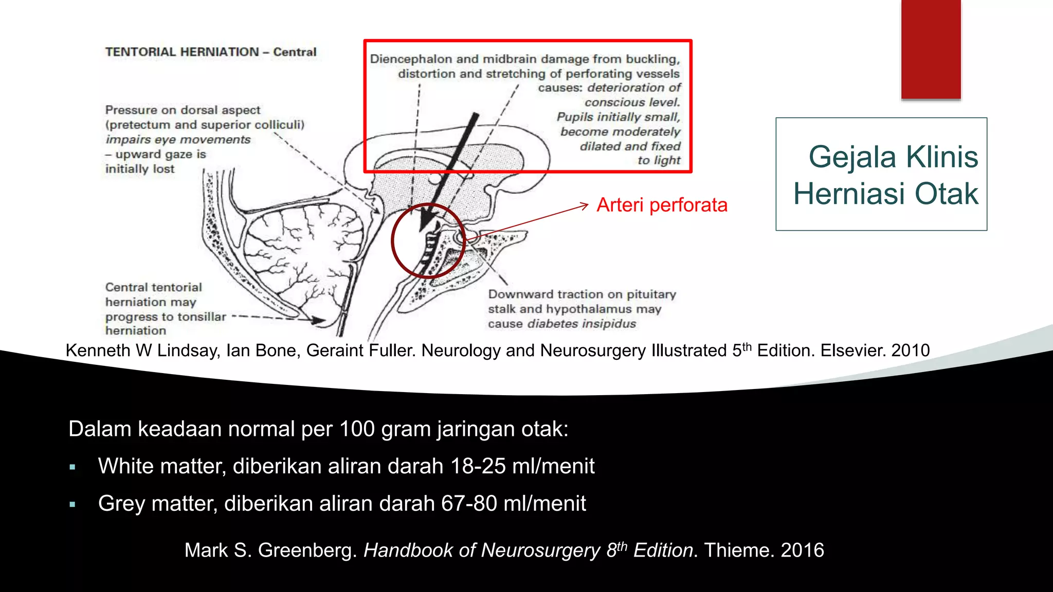 Tekanan Intrakranial | PPTX