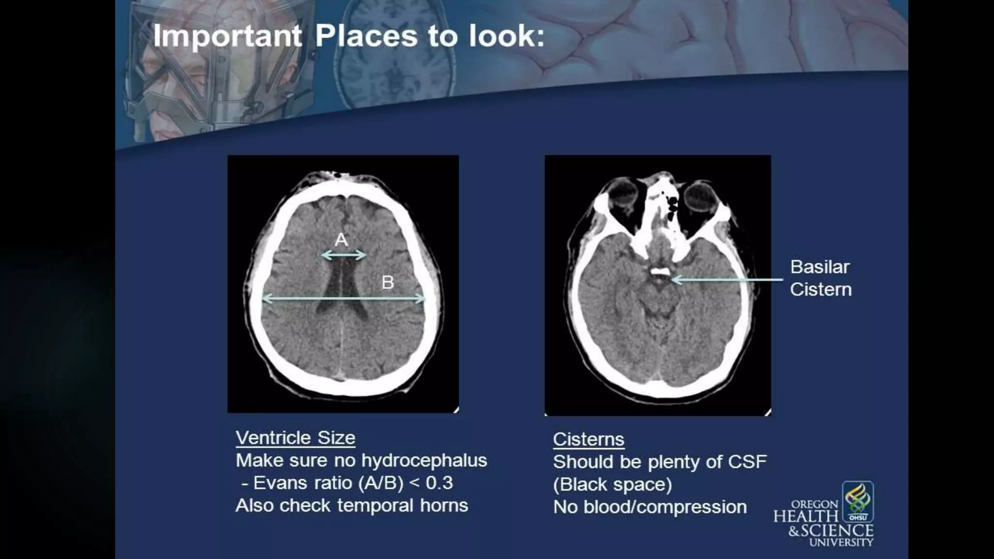 Tekanan Intrakranial | PPTX