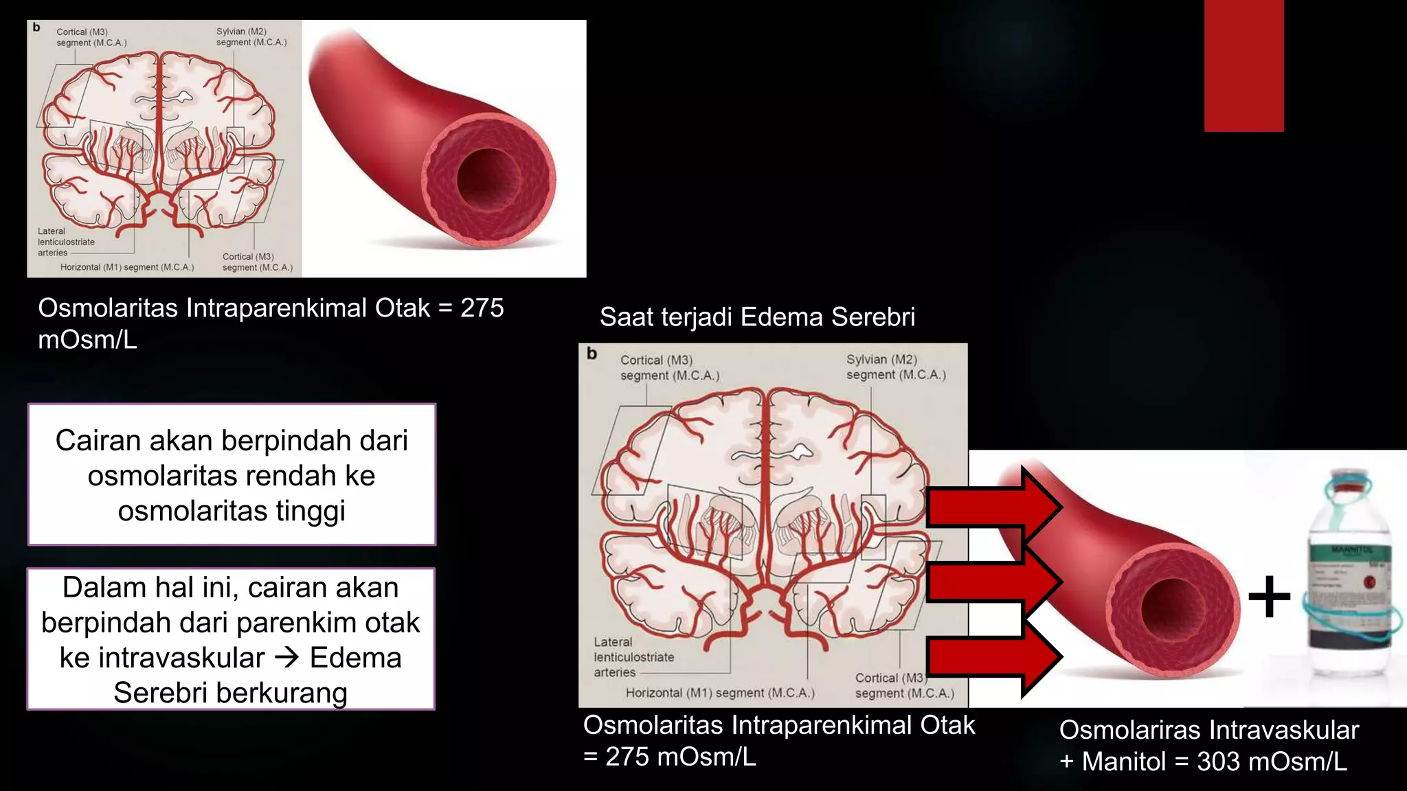 Tekanan Intrakranial | PPTX