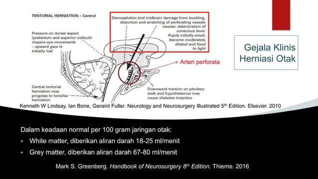 Tekanan Intrakranial | PPTX