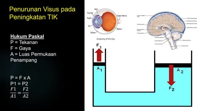 Tekanan Intrakranial | PPTX