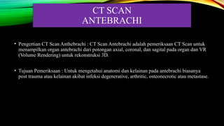 TEKNIK CT SCAN EKSTREMITAS ATAS.pptx TEKNIK CT SCAN DASAR | PPTX
