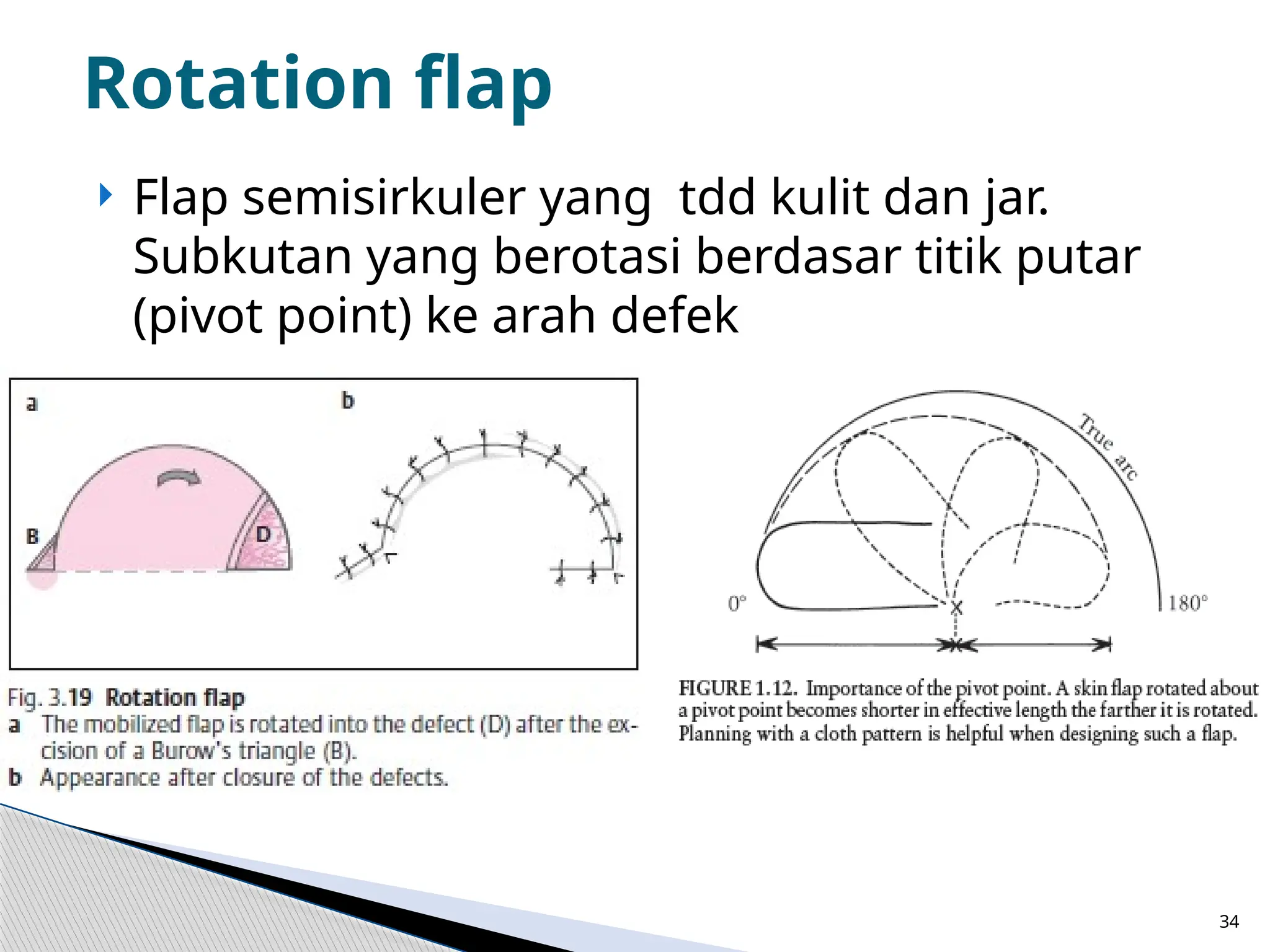 Teknik dasar dantherweg Prinsip bedah plastik.pptx
