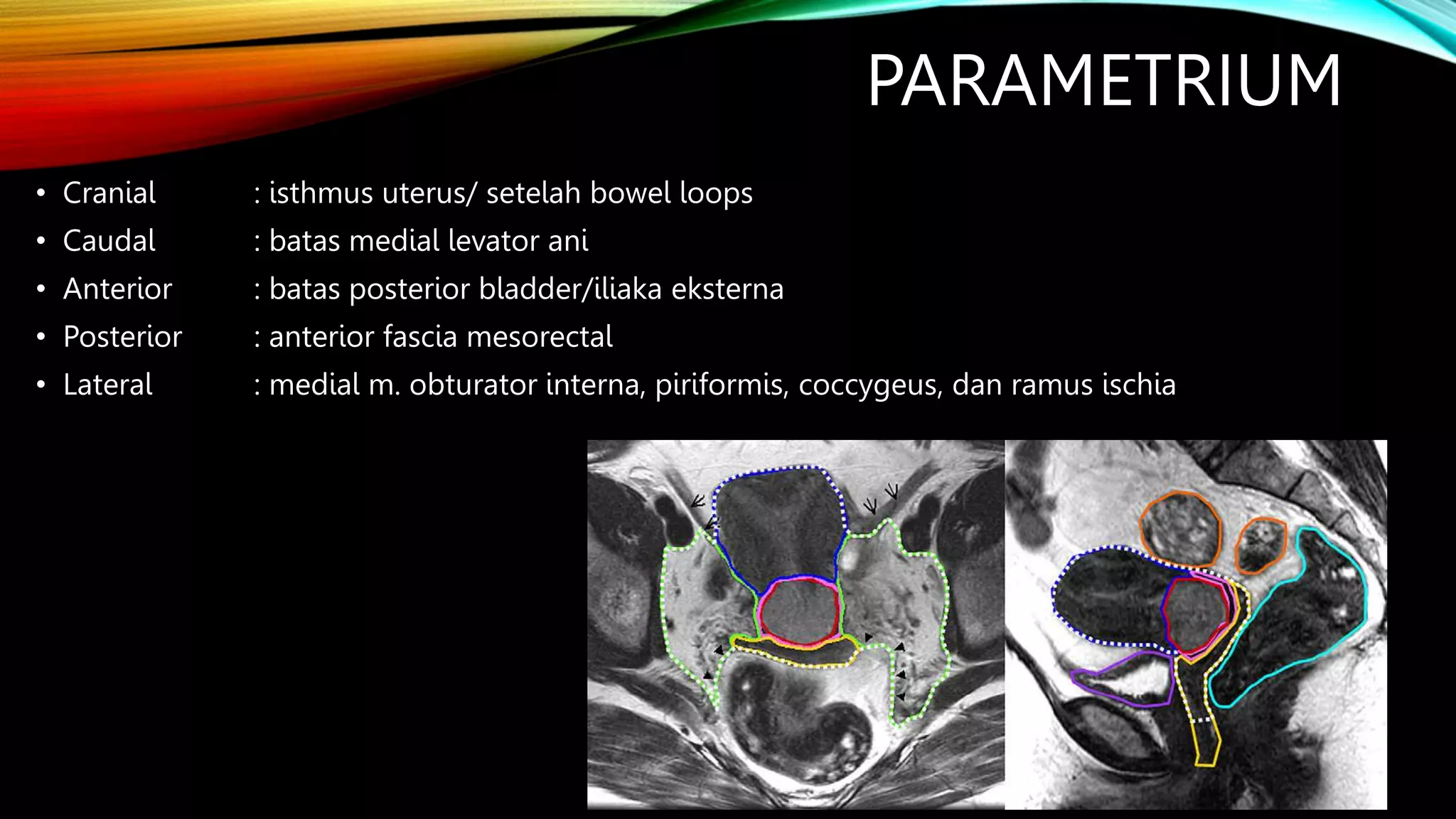 Teknik & Delineasi Ca Cervix.pptx