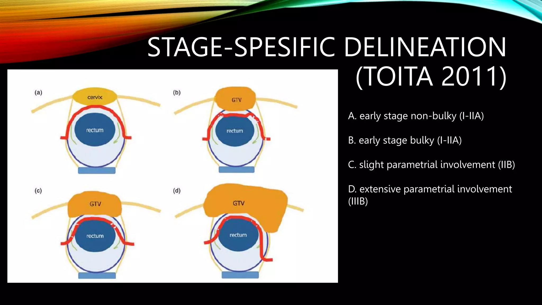 Teknik & Delineasi Ca Cervix.pptx