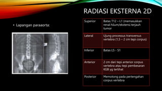 Teknik & Delineasi Ca Cervix.pptx