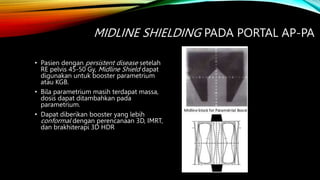 Teknik & Delineasi Ca Cervix.pptx