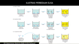 Teknik elisa sandwich | PDF