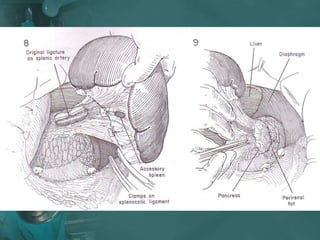 Teknik operasi | PPTX