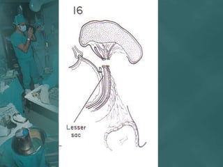 Teknik operasi | PPTX