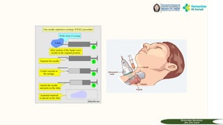 Teknik Operasi Biopsi Tumor (Core Biopsy, Incisi Biopsy, Excisi Biospsy ...