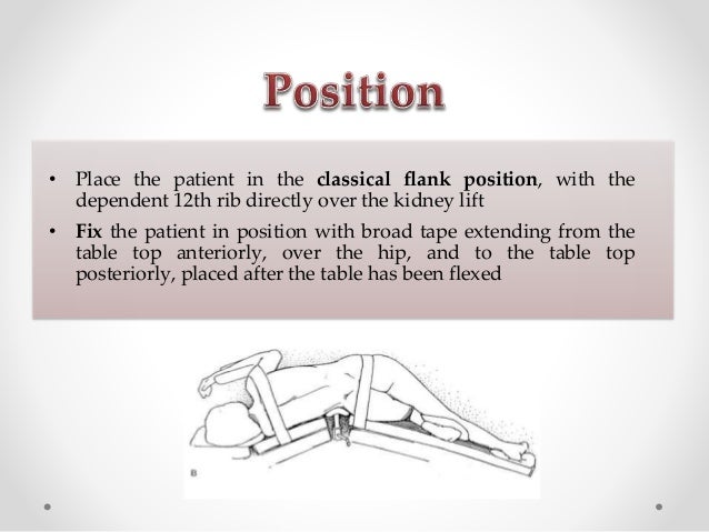 Open Ureterolithotomy