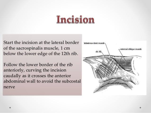 Open Ureterolithotomy