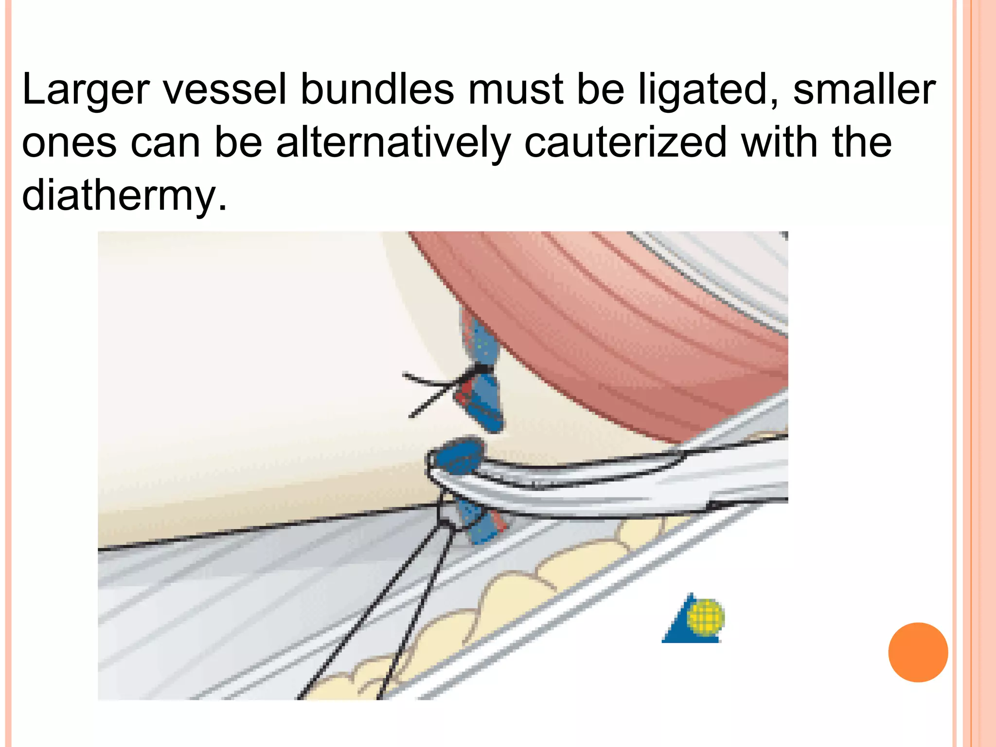 Teknik operasi orif femur | PPT